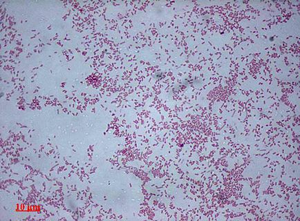 Proteus Mirabilis (Proteus Mirabilis)