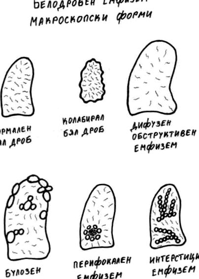 Emfizem pulmonar; cauze, simptome și tratament
