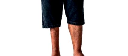 Какво е мускулна атрофия Симптоми, причини и как да се лекува