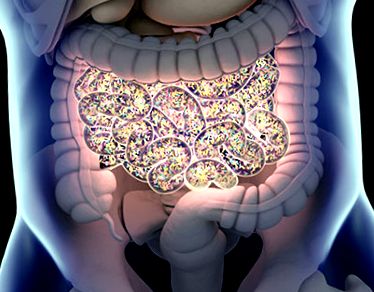 Токсичен мегаколон - причини, симптоми и лечение