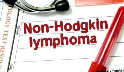 Non-Hodgkinov lymfóm - príznaky, diagnostika, terapia, žltý zoznam