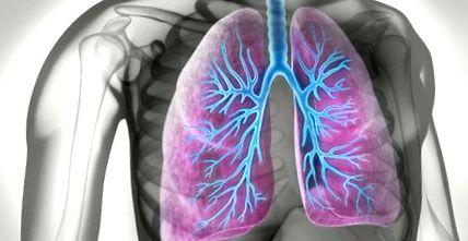 Čo je to bronchitída, príznaky, trvanie