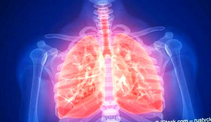 Chronická bronchitída - príznaky, diagnóza, terapia, žltý zoznam