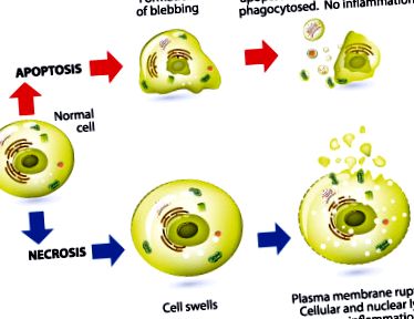Некроз - причини, симптоми та лікування