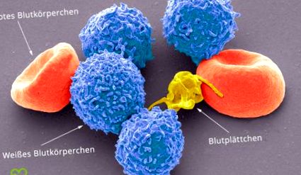 Trombocytopénia (trombopénia), príčiny, príznaky, hodnoty, terapia