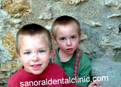 Детска стоматология - клиника по стоматология и орална хирургия Sanoral ...
