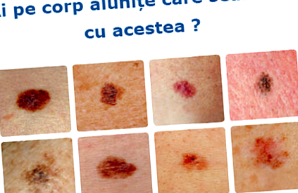 10 príznakov, že môžete mať rakovinu