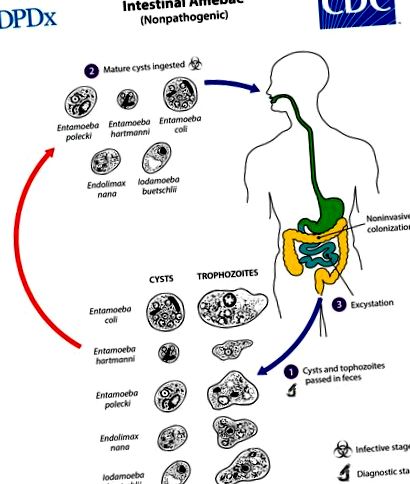 Enterobiosis behandeling - Приготвяне на аскарида лямблиоза