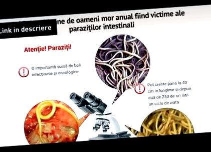 Paraziták elleni gyógyszerek a földön, papilláris urothelialis ...