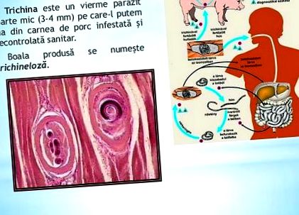 Paraziták az egész testben - Szemölcsök kezelése
