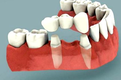 Клиника по протезиране Megadent