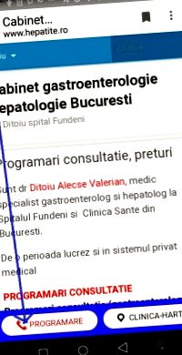 Príznaky, liečba, strava dlhého čreva (dolicocolon) Súkromná kabinet ...