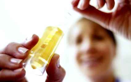 A vizeletgyűjtés előkészítése - orvosi rendelő Endokrinológiai Diabetes ...