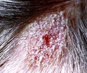 Tipuri de pecingine la câini, simptome, tratamentul unui câine sau ...